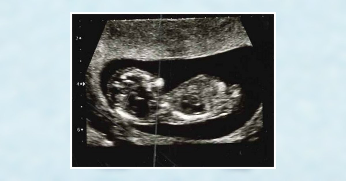 Aiden Michael Slaughter Obituary March 8, 2015 - Newcomer Akron