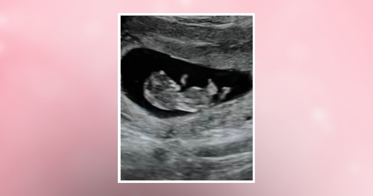 Linette Jimenez Lopez Obituary June 13, 2025 - Hall Wynne Funeral Home